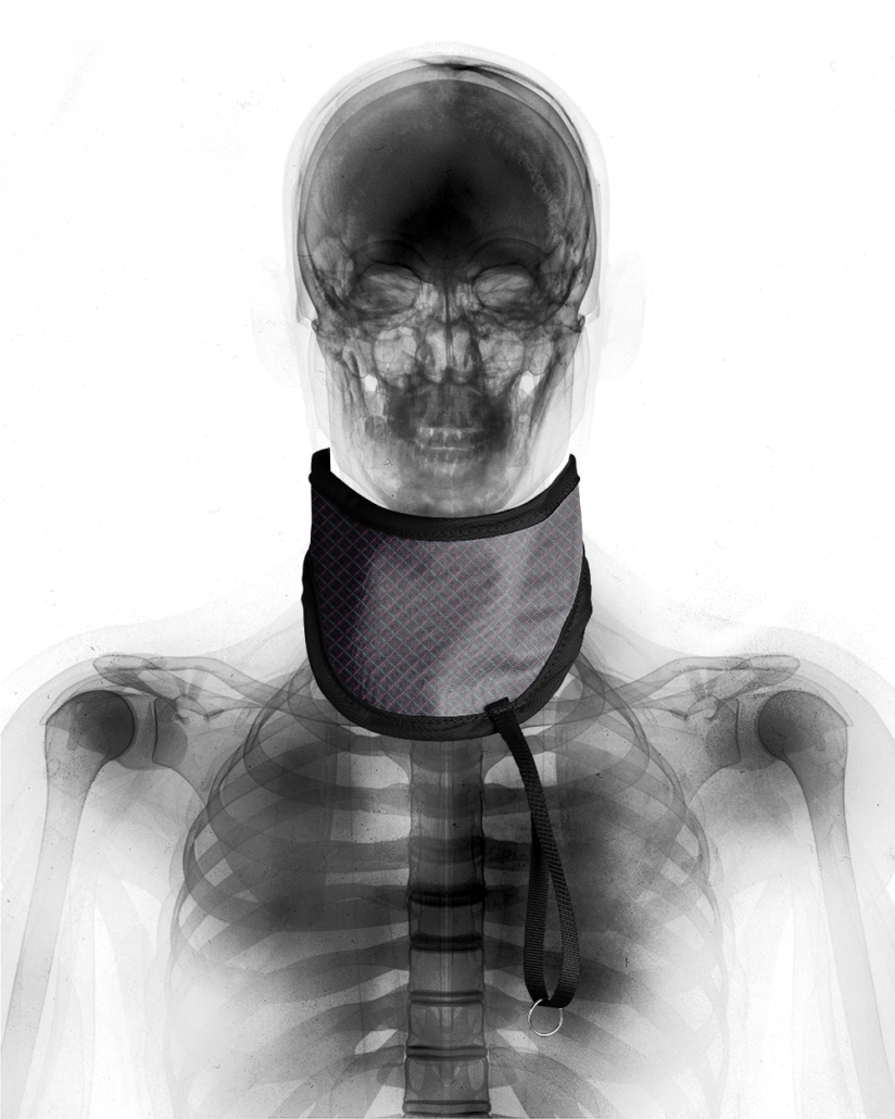 Burlington by Xenolite - Com MedCor